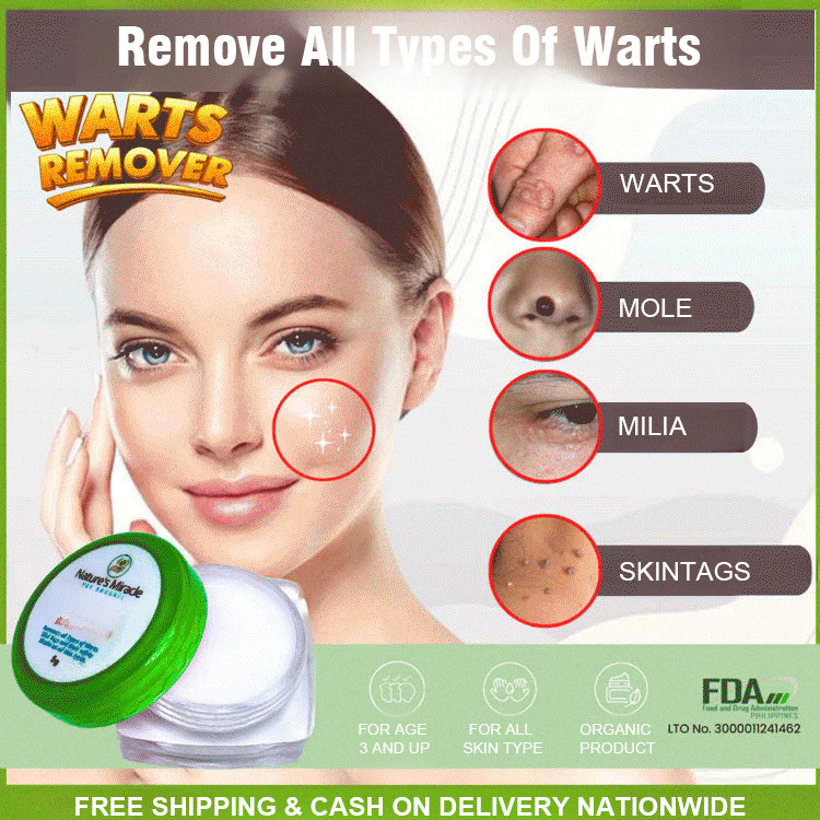 【Instant removal】Strong Warts and Mole removal cream Original Formula ...