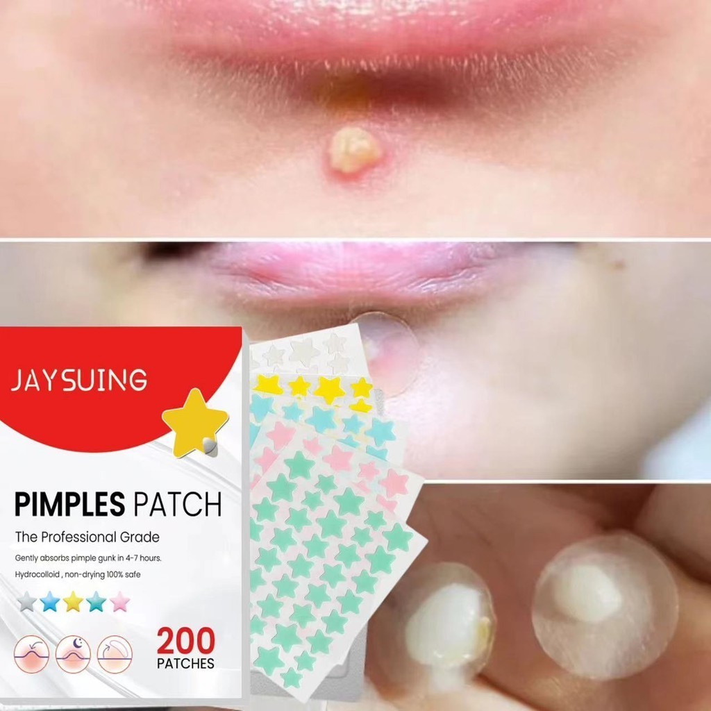 Acne Pimple Patch Invisible Acne Treatment Stickers Treatment Pimple ...