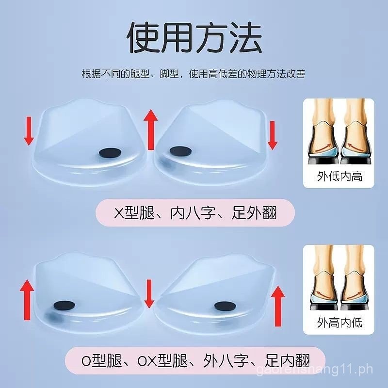 Correct leg shape ox Permanent Leg Straightening Insoles for Legs ...