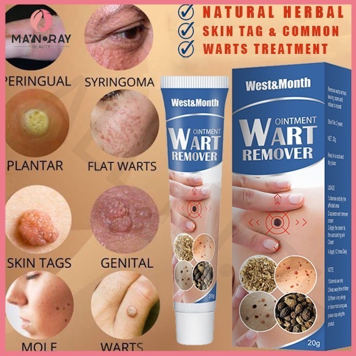 Warts Remover Cream West&Month Warts Removal Antibacterial Wart ...