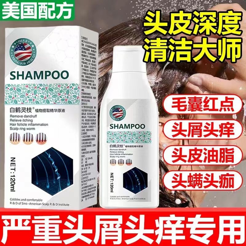 Shampoo for Rapid Dandruff Removal, Anti-Itch, Oil Control, Mite Removal, Seborrheic Scalp ...