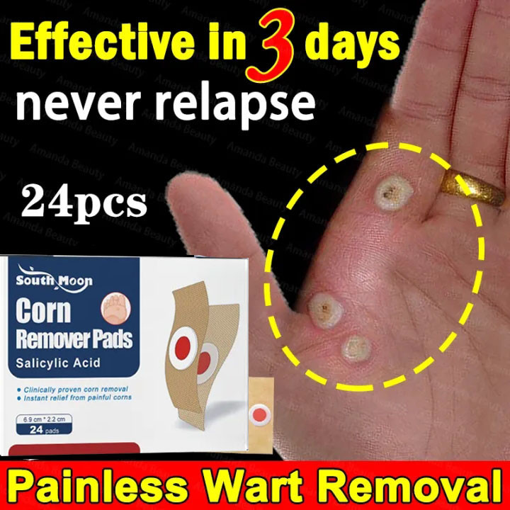 24PCS Warts remover Foot Corns Remover Patch Pad To remove calluses ...