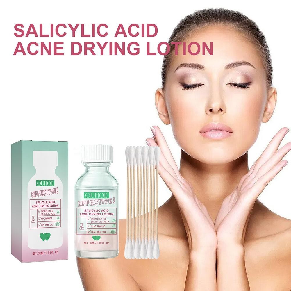 30ml Salicylic Acid Acne Lotion Spot-On Acne Repair Solution For Facial ...