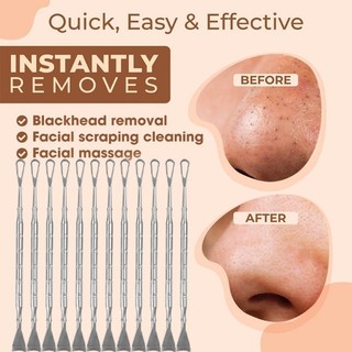 Silver Blackhead Comedone Acne Pimple Blemish Remover Tool Double Ended ...