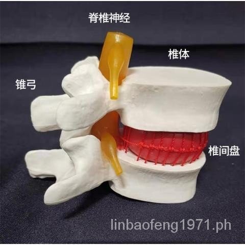 Intervertebral Disc Model Genuine Goods Medical Human Lumbar Vertebra ...