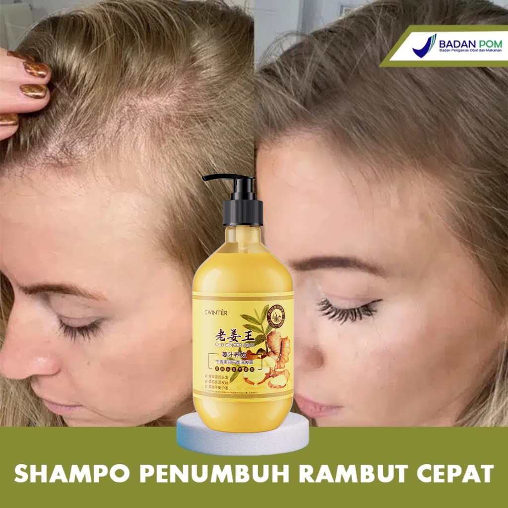 Ginger Hair Shampoo Fast Regrowth Hair Thick Anti-Hair Loss Anti ...