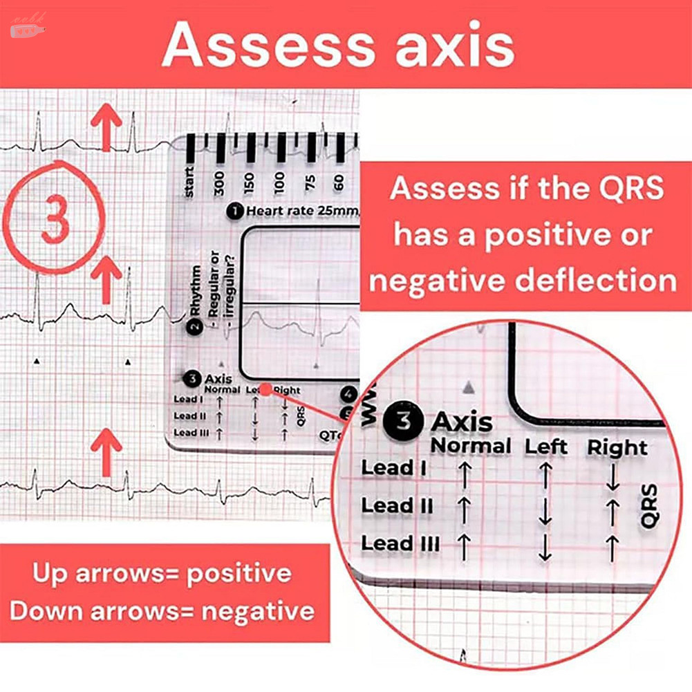 Small Electrocardiogram 7 Step Ruler Transparent EKG Calipers Measuring ...
