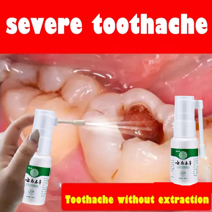 Toothache Oral Spray Relieves Periodontitis Tooth Decay Pains Toothache ...