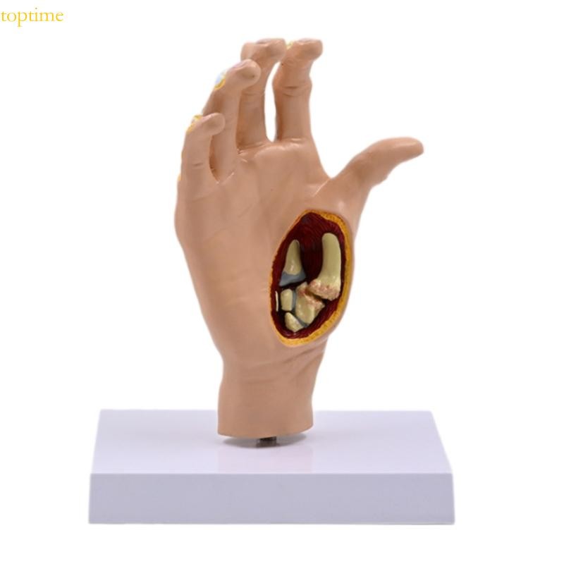 Top 1 1 Hand Joint Model Medicals Anatomical Hand Skeleton Model with ...