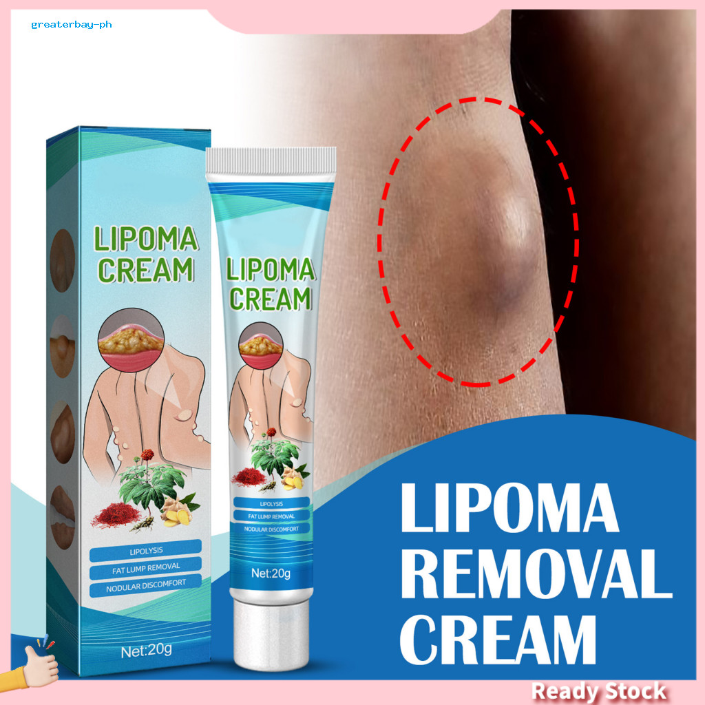 [Greaterbay] 20g Fatty Lump Cream Painless Unblocking Continuous ...