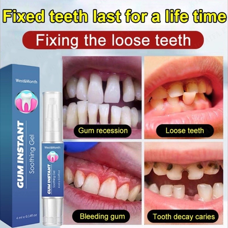 4ml Gum Instant Soothing Gel Receding Gums Inflammation Relieve ...