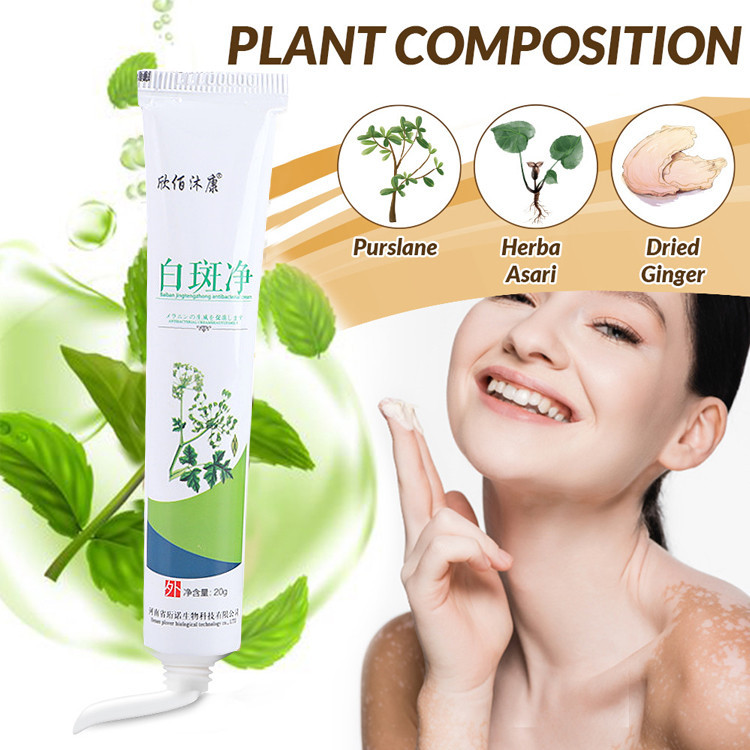 White Spot Removal Cream for Flawless Skin | Shopee Philippines