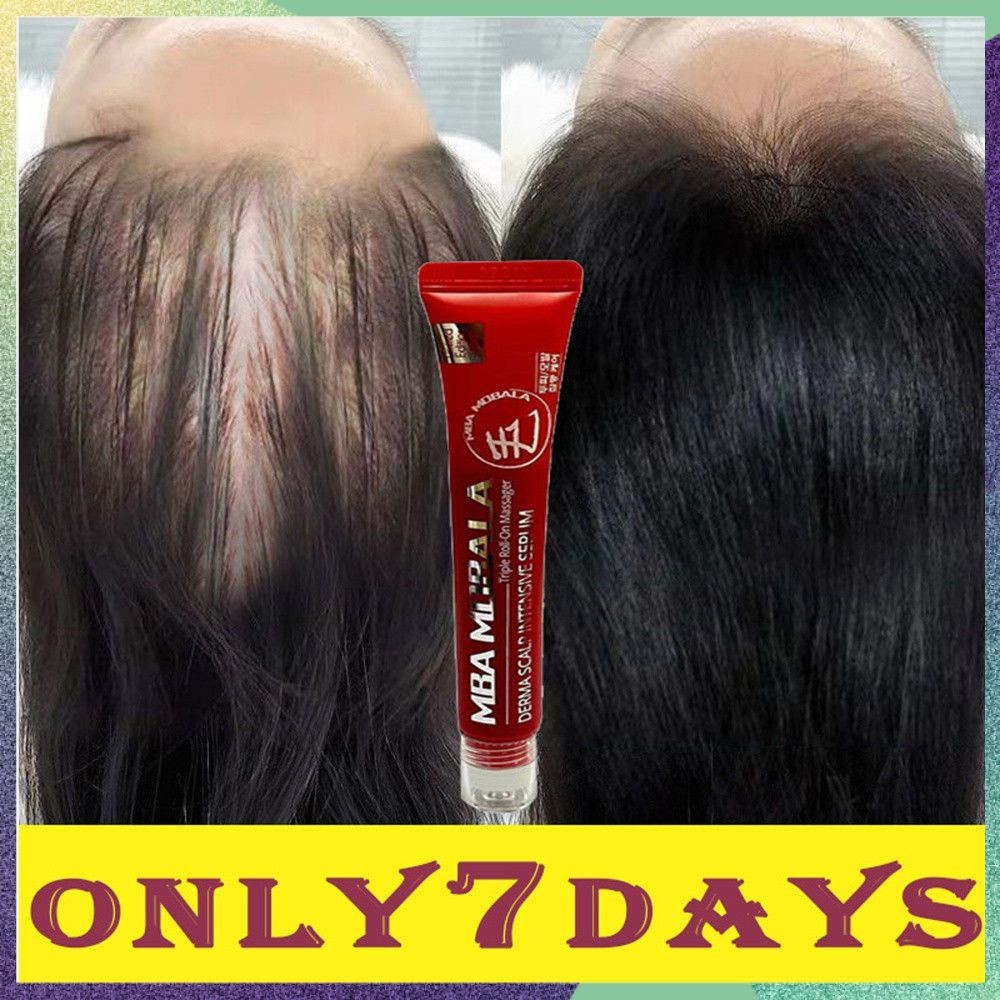 Rapid Hair Growth Essential Oil, Unisex Regenerative Effective Baldness ...