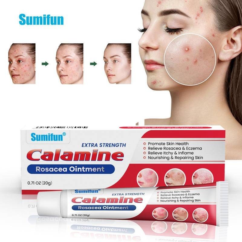Extra Strength Calamine Rosacea Ointment Acne Repair Face Soothing ...
