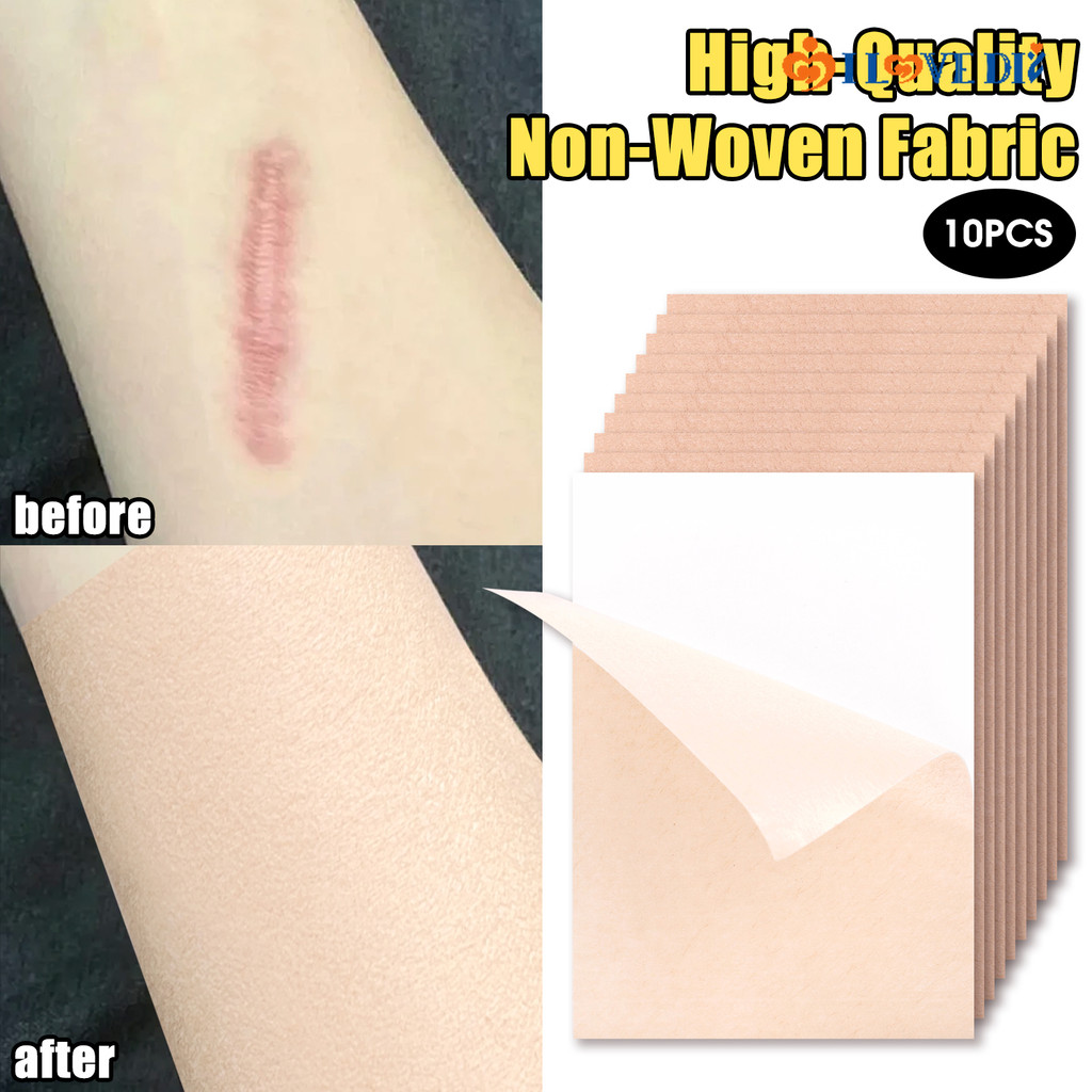 Portable Cover Flaw Birthmark Concealing Invisible Patch - Temporary ...