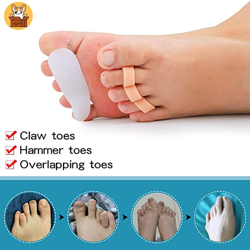 【Am-az】 1Pair Silicone Gel Hammer Toe Straightener Corrector For Curled ...