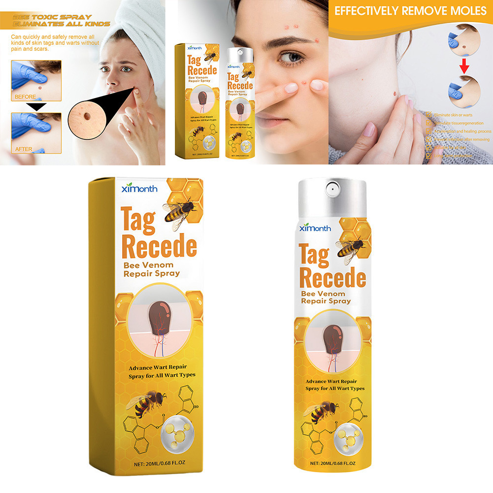 Bee Venom Treatment Spray 20ml Wart Skin Tags Removal Treatment Spray ...