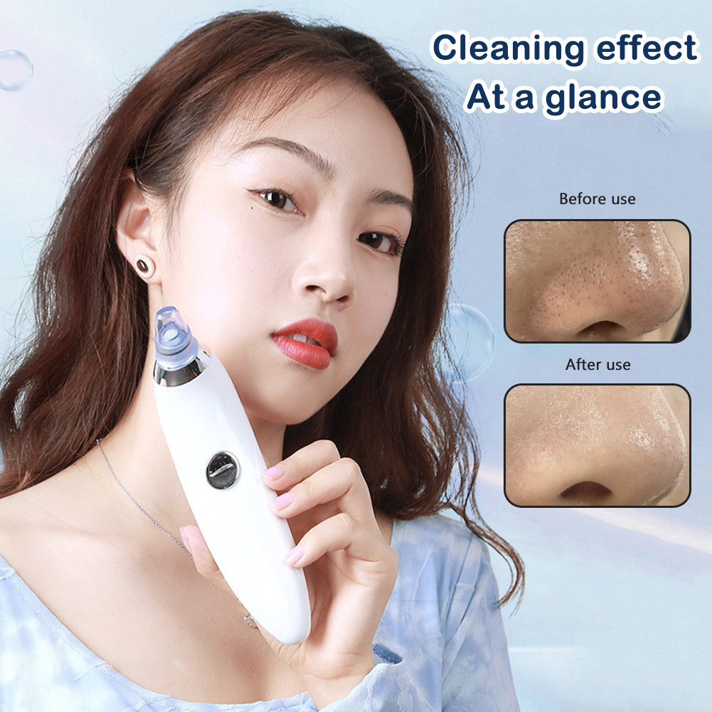 Electric Blackhead Remover Deeply Facial Pores Cleaning Tool Skin ...