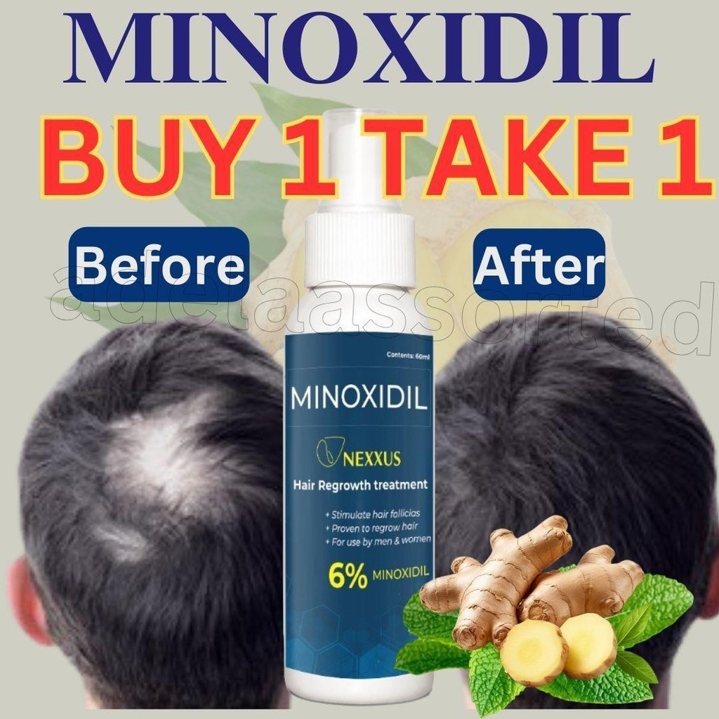 Minoxidil 6% 60ml Natural Hair Grower Topical Solution for Men and ...