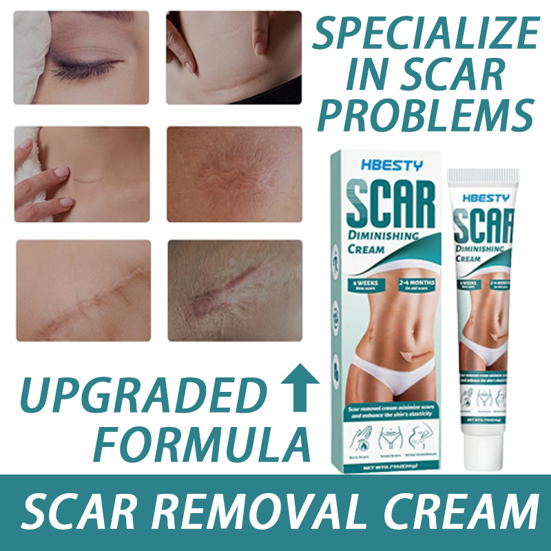 HBESTY 20g New scar removal cream remove scars without leaving marks ...