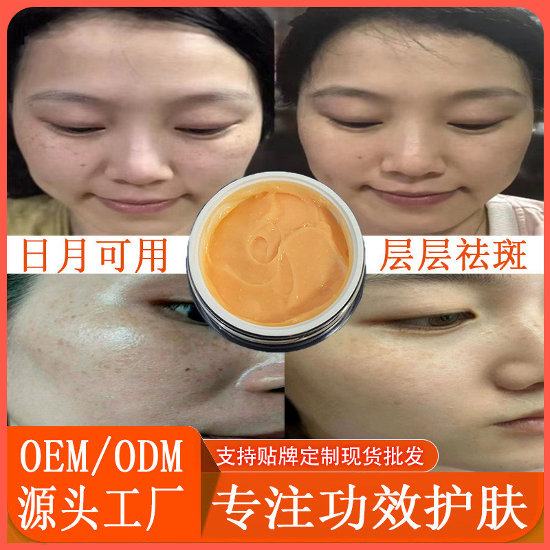 [Ready Stock] Freckle Removal Cream 577 Fade Spots Arbutin Freckle ...