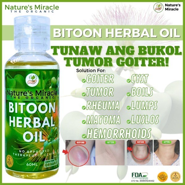 Bitoon Herbal Oil Bitoon Oil Original Bitoon Herbal Oil Original Tunaw ang Bukol Goiter Cyst ...