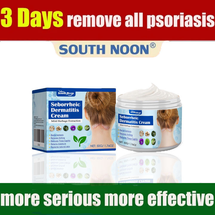 Anti-Dandruff Cream for scalp psoriasis Refreshing Oil Control Deep ...