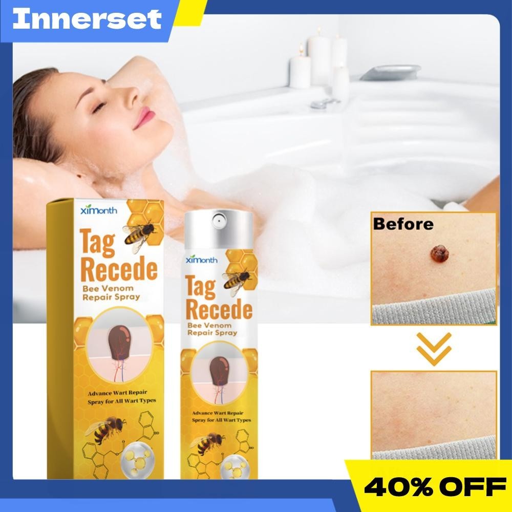 20ml Bee Venom Spray Tag Recede Bee Venom Spray Bee Venom Treatments ...