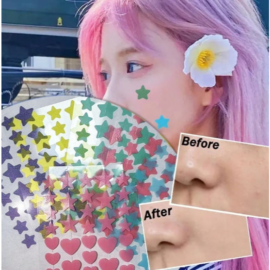 Gw ACNE PATCH CUTE MOTIF ACNE REMOVAL STICKER / ACNE PIPLE PATCH CUTE ...