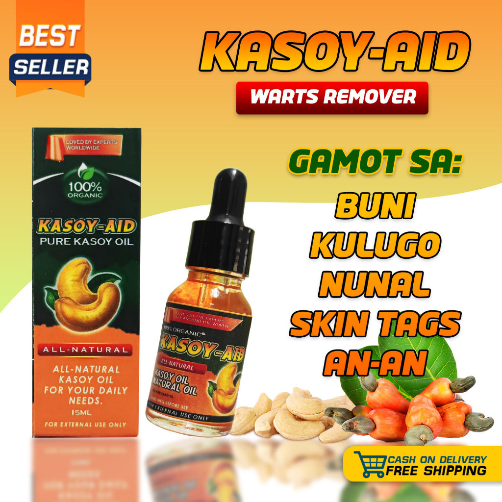 Warts Remover Kasoy Oil for Skin Tags, Nunal, Kulugo, Kalyo, Buni, An ...