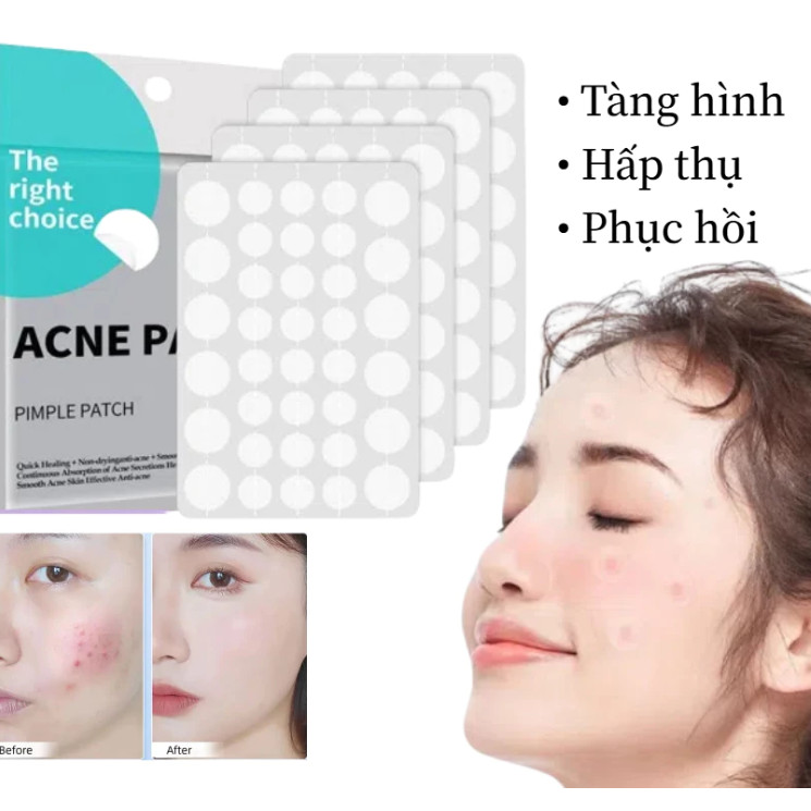 Set of 36 Waterproof Raw Acne Absorbing Patches | Shopee Philippines