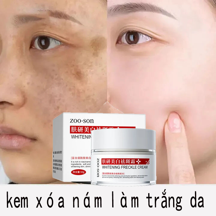 Pekas Remover Effective Melasma Cream Anti Freckle Collagen Original ...