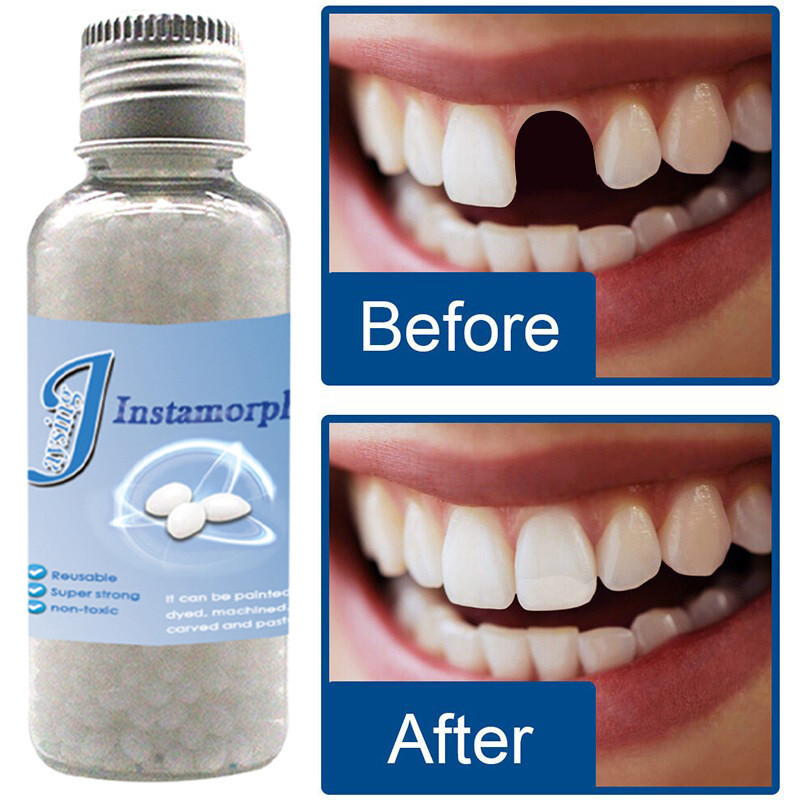 Original Moldable Tooth Filling Solid Denture Material Temporary Tooth ...