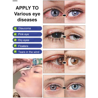 Vision Eye Drops Gentle Comfort Eye Care Eyes Keep Clear Eyes Comfort ...