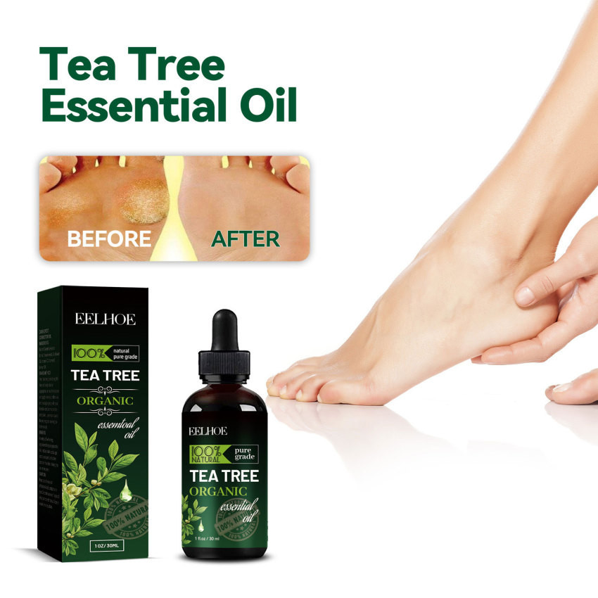 GG+Red tea tree essential oil lightens a-cne scars, moisturizes feet ...