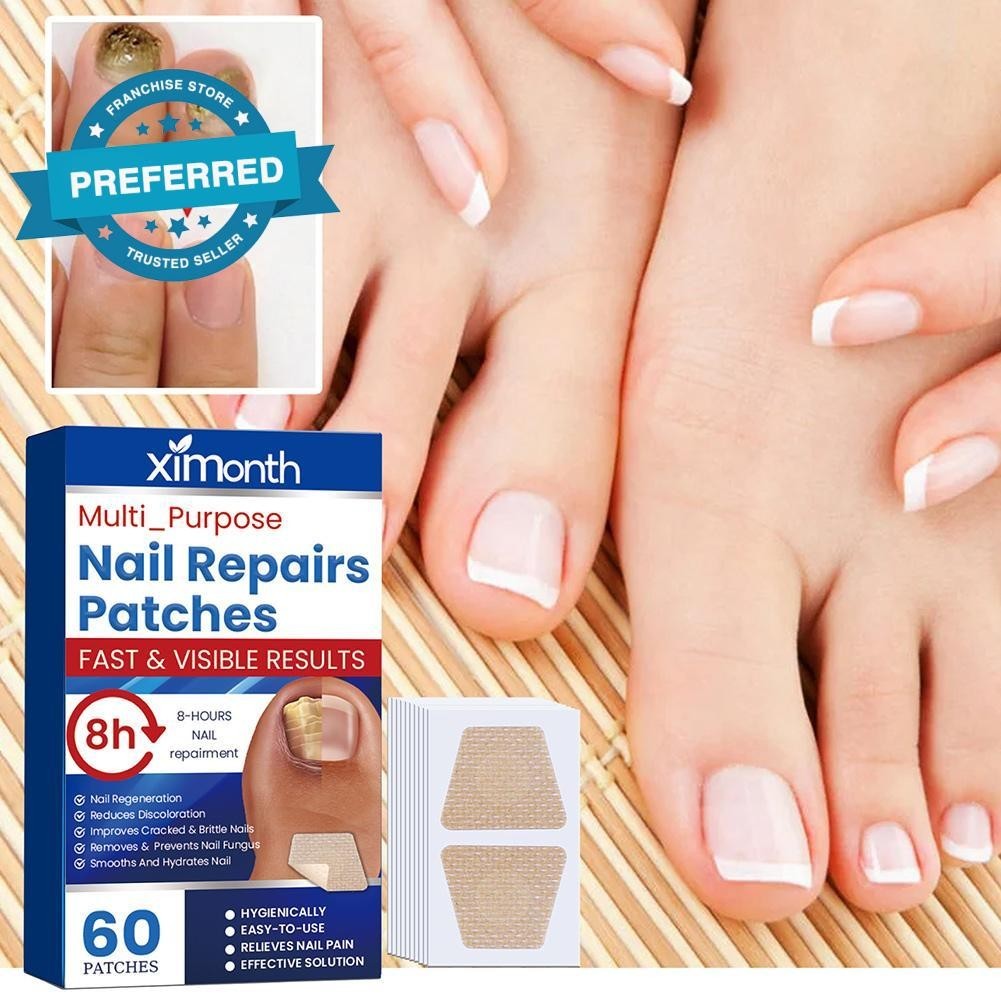 Nail Treattment Patch Anti Fungal Nail Correction Stickers Ingrown ...