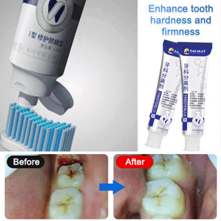 Dental Separator Toothpaste Loose Teeth Gum Shrinkage Repair Toothpaste ...