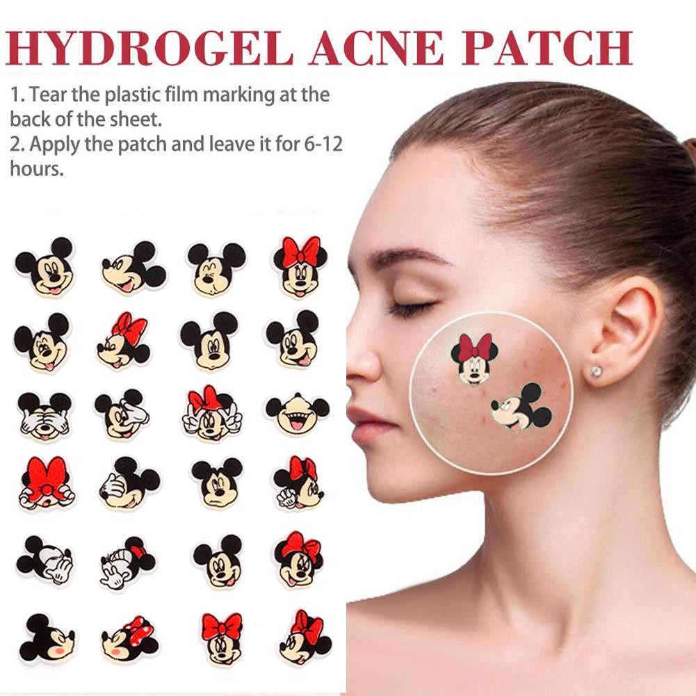 Cartoon Cute Mickey Mouse Shaped Acne Patches Beauty Sticker K4d0 ...