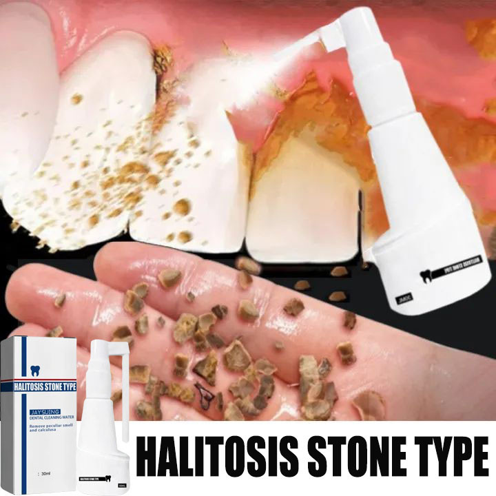 Calculus Halitosis Stone Type Teeth Cleansing Whitening Effective ...