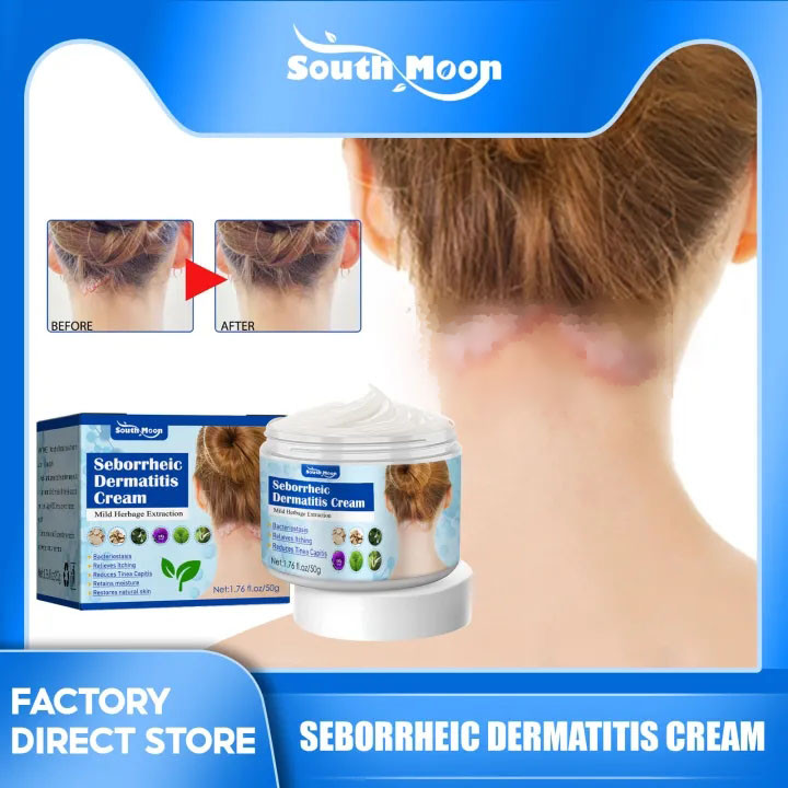Anti Dandruff Cream Hair growth Cream For Scalp Itching And Dandruff ...