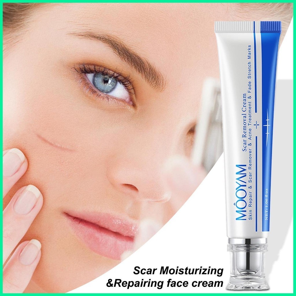 Stretch Mark Cream Scar Gel Scar Away Silicone Gel Burn Cream Burn Gel ...