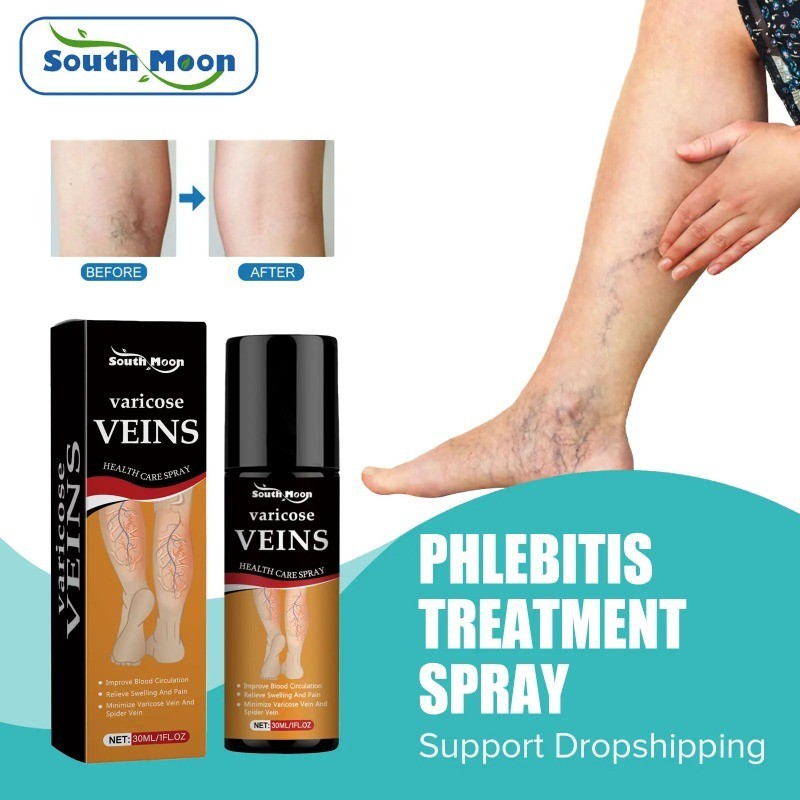 Vein Repair Spray Vasculitis Phlebitis Medical Treatment Relief ...
