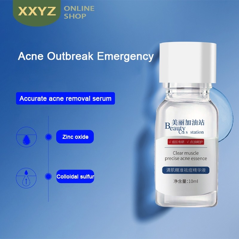10mL Acne Removal Essence Blackhead Removal Essence Skin Clearing And Pore Refining | Shopee ...
