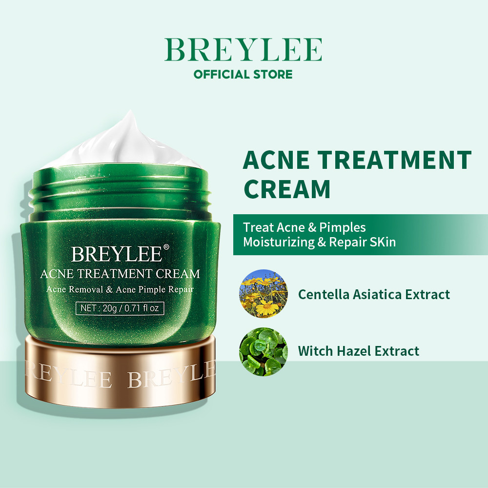 Breylee Acne Treatment Cream Anti Acne Face Cream Pimple Removal Spots Oil Control Shrink Pores ...