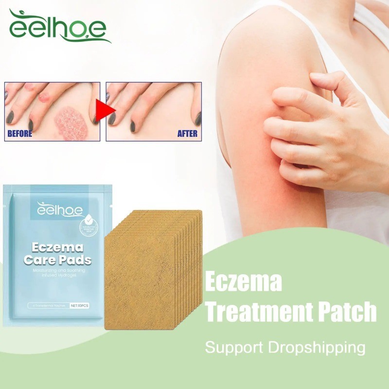 EELHOE Eczema Treatment Patch Cure Psoriasis Hand Tinea Inhibit ...