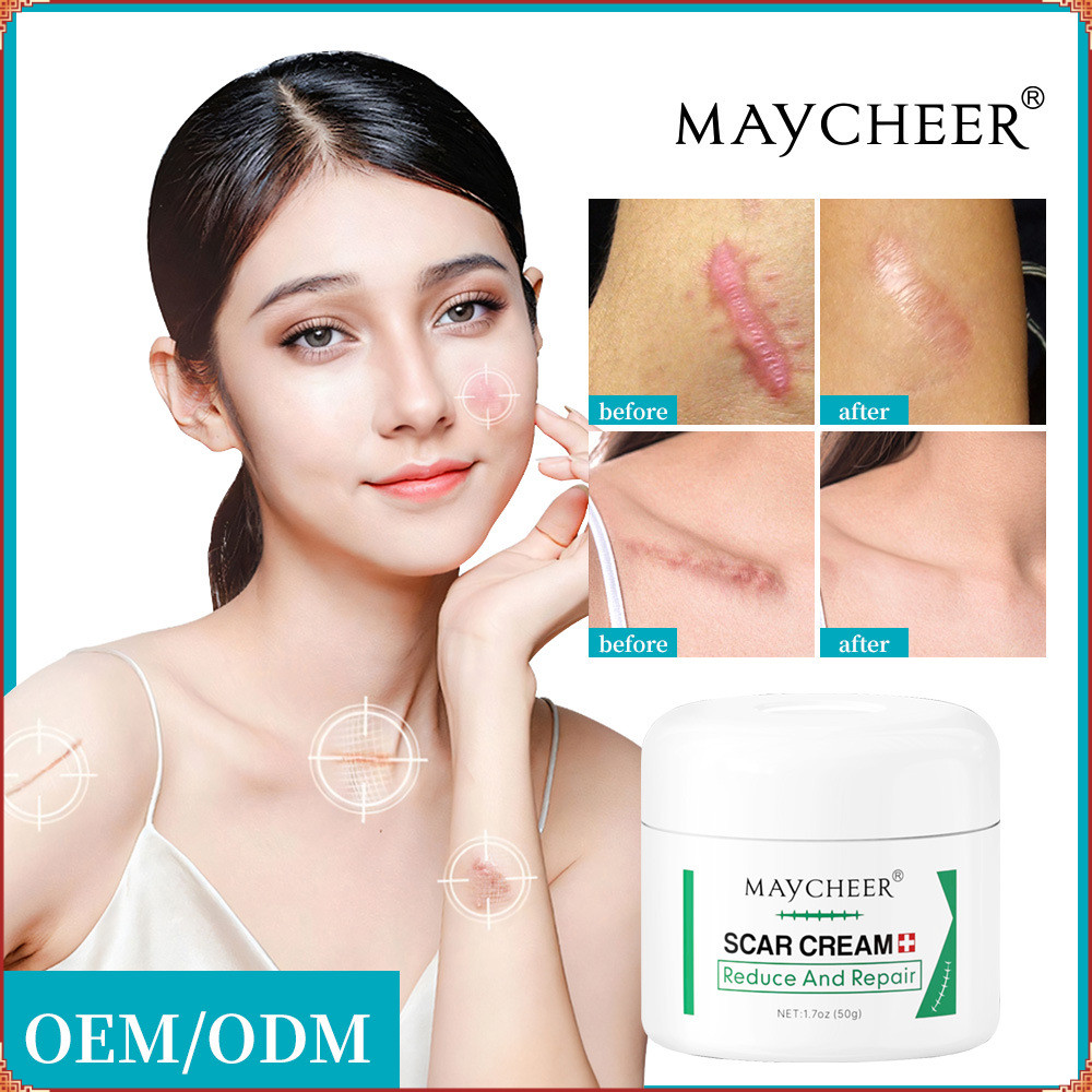 MAYCHEER Scar Cream Scar Remover for Old Scar On Leg Stretch Mark ...