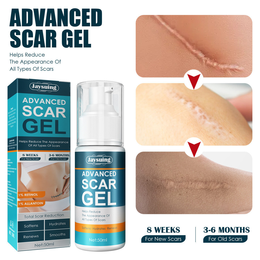 advanced scar gel淡化伤疤霜凝胶 产后妊纹烫烧疤手术平滑肌肤皮肤增生伤痕修护霜 advanced scar gel ...