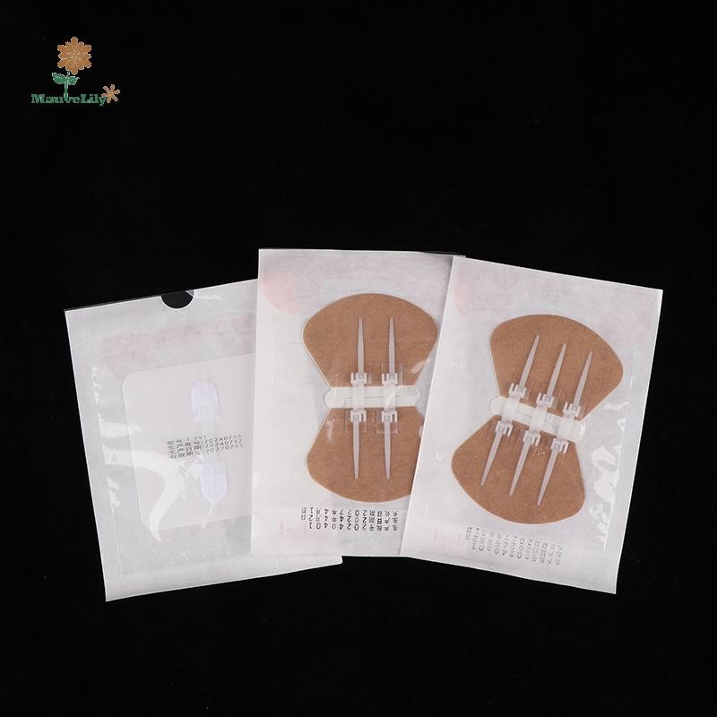 LILY Zipper Band-aid Painless Wound Closure Device Suture-free Wound ...