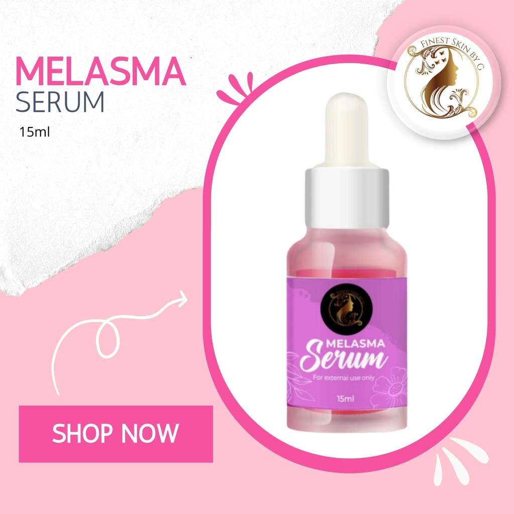 Finest Skin By G Melasma Serum 15ml | FSG | Shopee Philippines