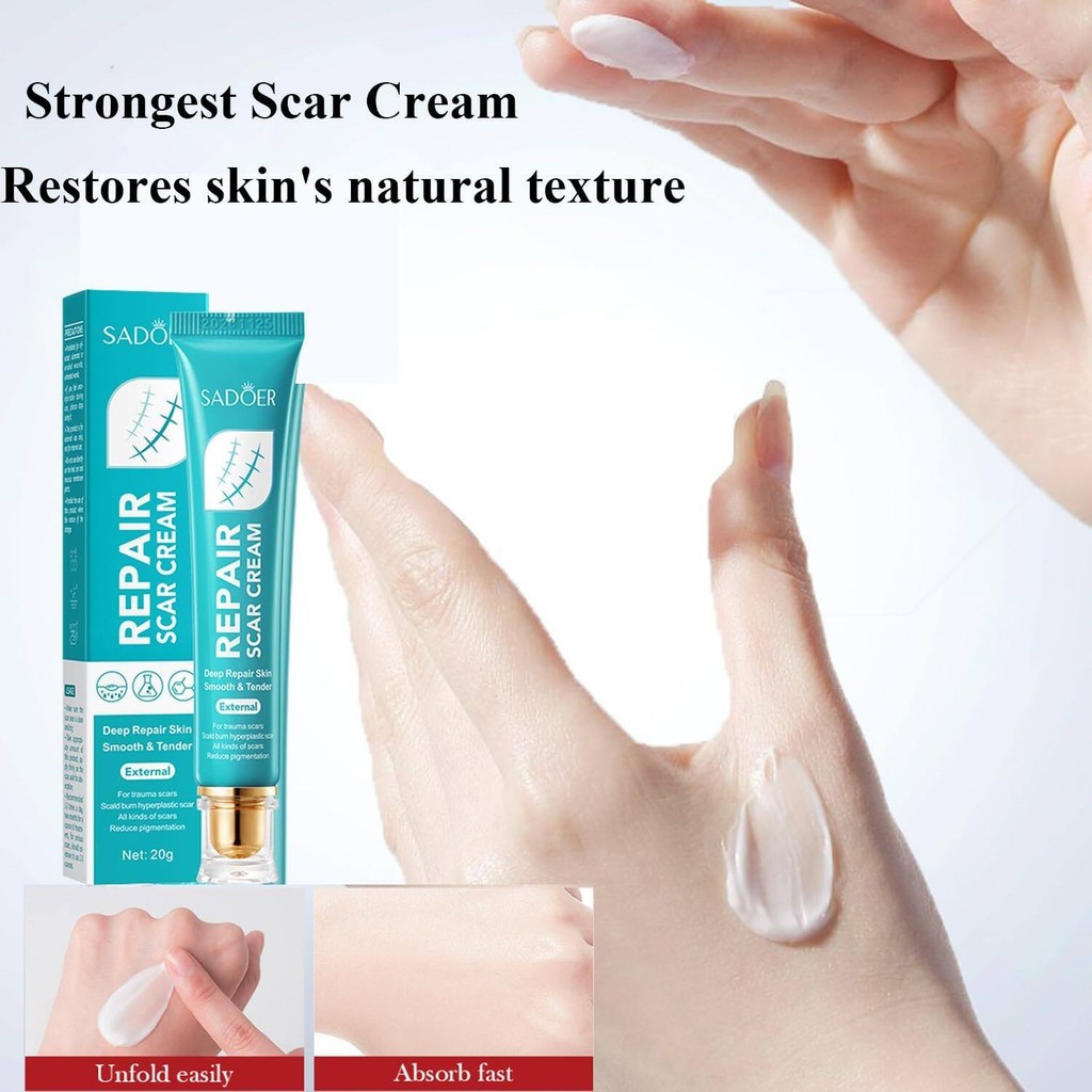 Scar Remover Cream Acne Scar Remover 4 Plant Extracts Whitening ...